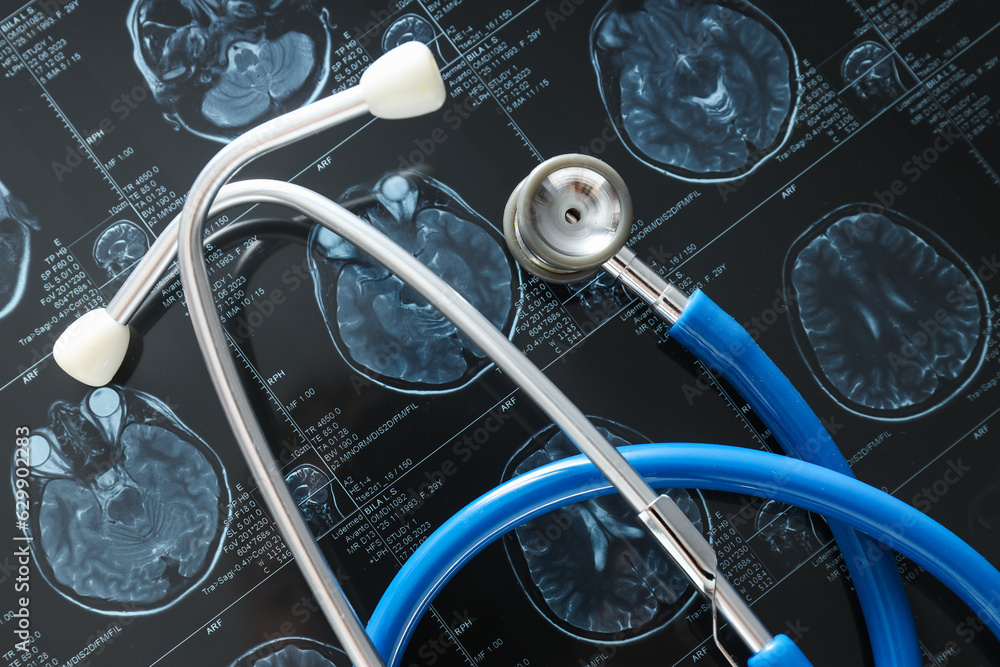 MRI or magnetic resonance imaging of the head and brain with a ...