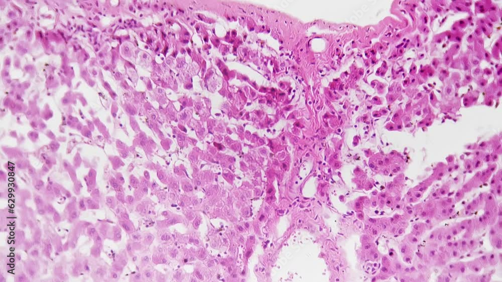 Macro footage of liver vessel injection in section under microscope ...