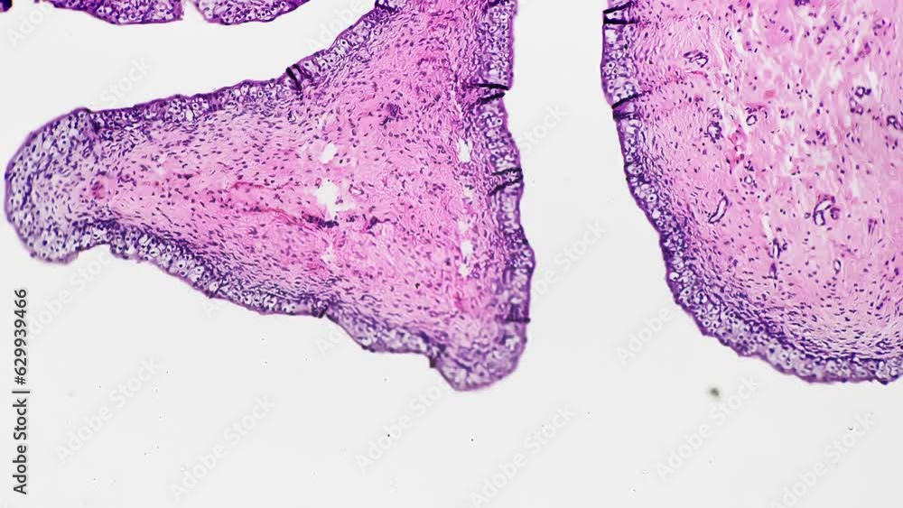 Bladder of human being in section filmed under microscope 100x for ...
