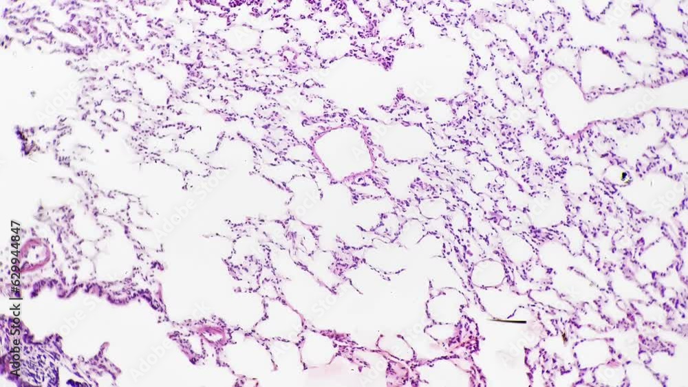 Macro footage of human bronchiolus in section filmed under microscope ...