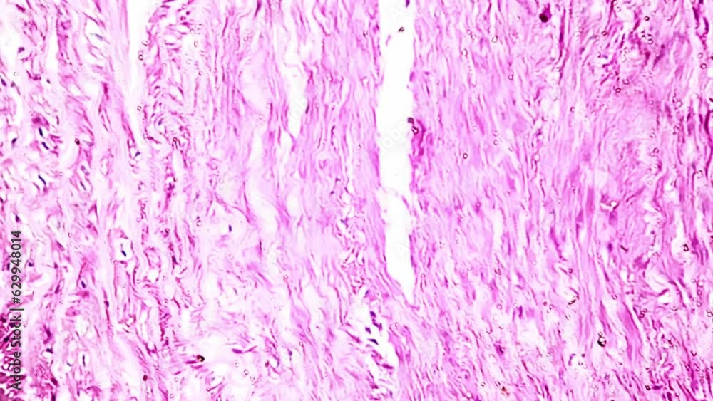 Human large artery examined in an experiment and observed under a ...