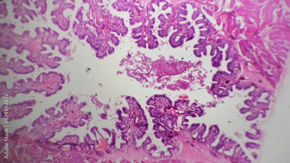 Cervix in section filmed under light micrograph with 40 times ...