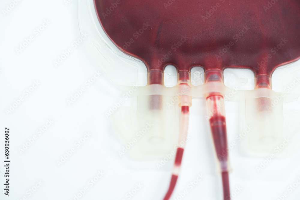 Blood pack for transfusion from donor.Full blood bag for accident's ...
