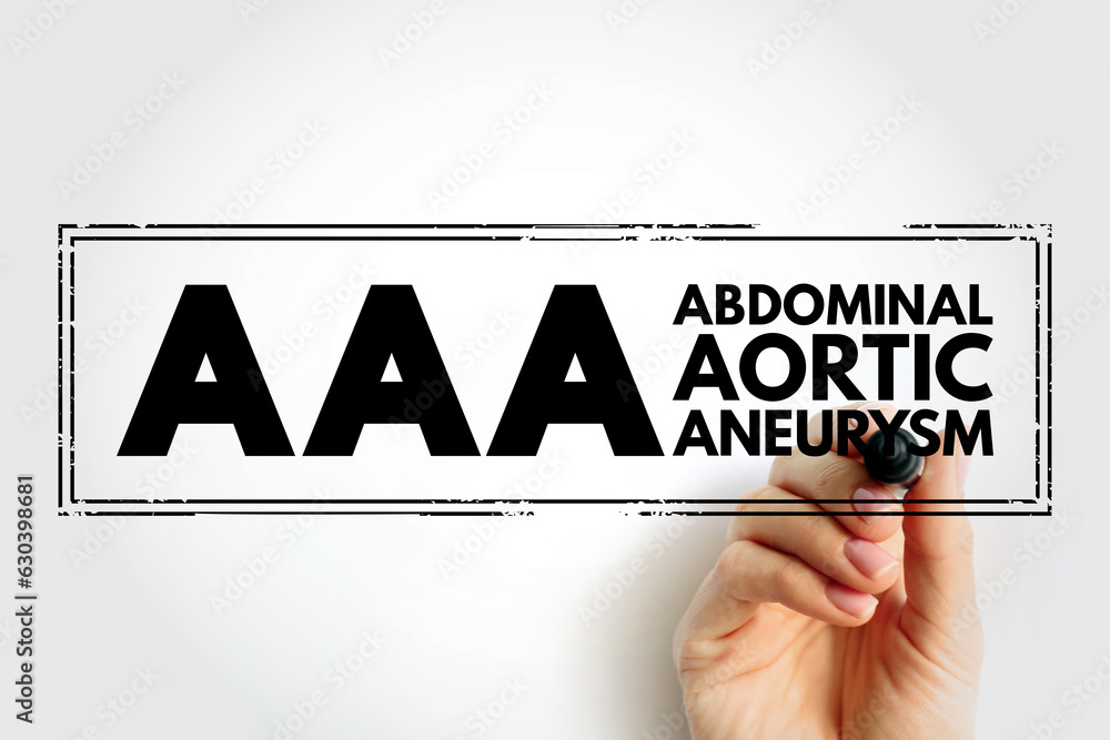 AAA Abdominal Aortic Aneurysm - localized enlargement of the abdominal ...