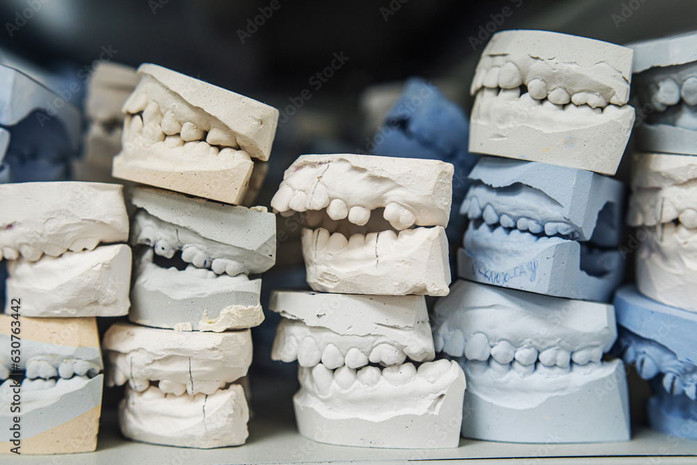 Photo & Art Print Warehouse of plaster models of human jaws in an ...