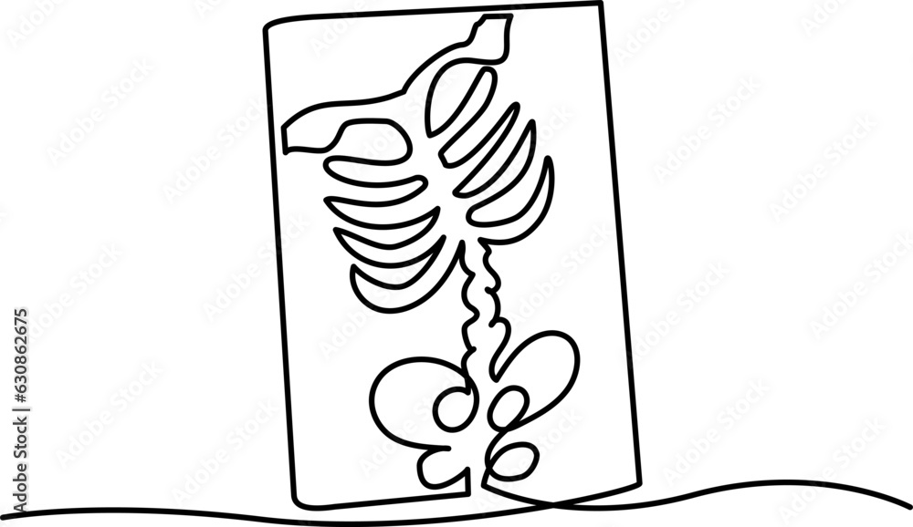Chest x-ray icon. A simple line drawing of the bones of the thorax on ...