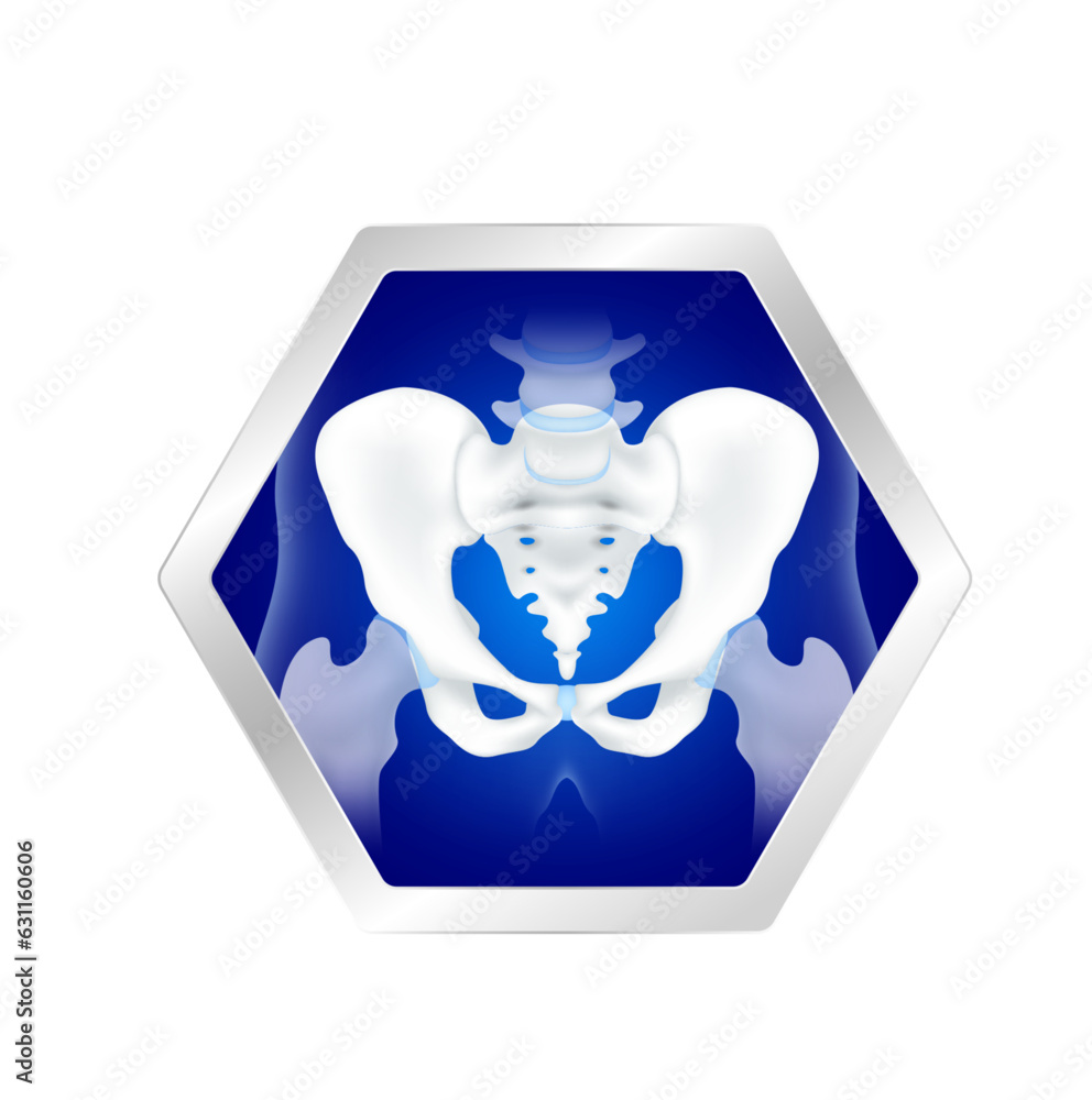 Hexagon Label Aluminum Human Pelvis Or Hip Bone Anatomy Joint 9078