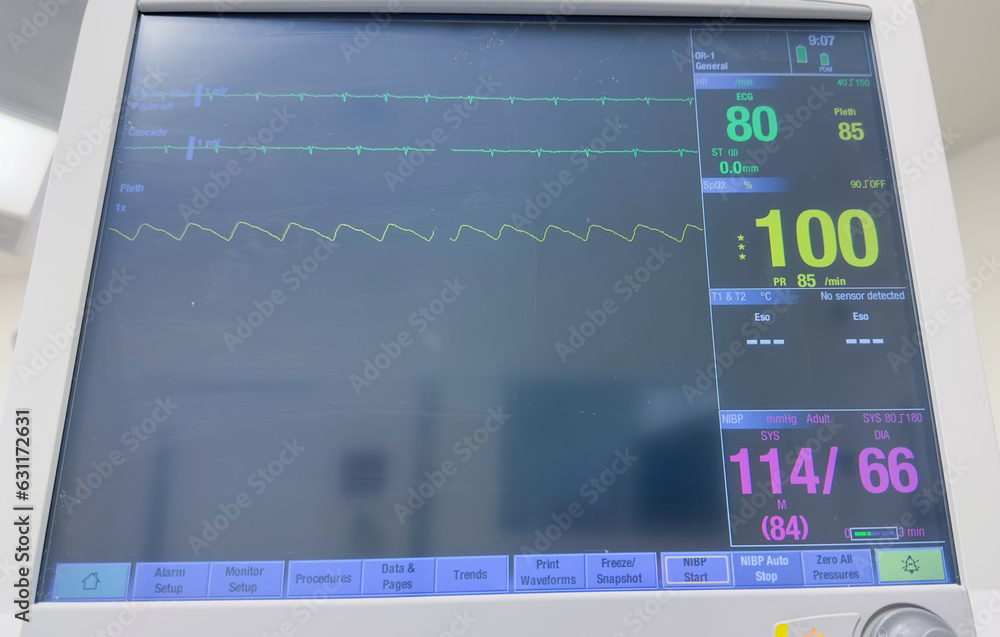 Vital signs unite in a symphony of life on the hospital monitor: blood ...