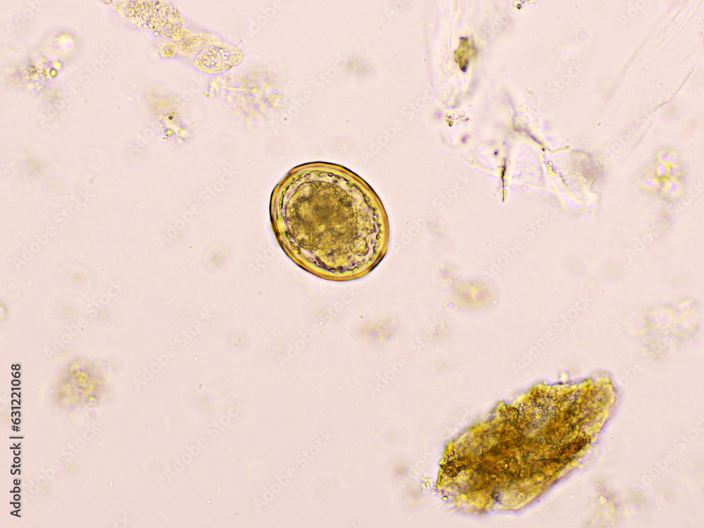 Poster Egg of Ascaris lumbricoides (roundworm) in human stool, analyze ...
