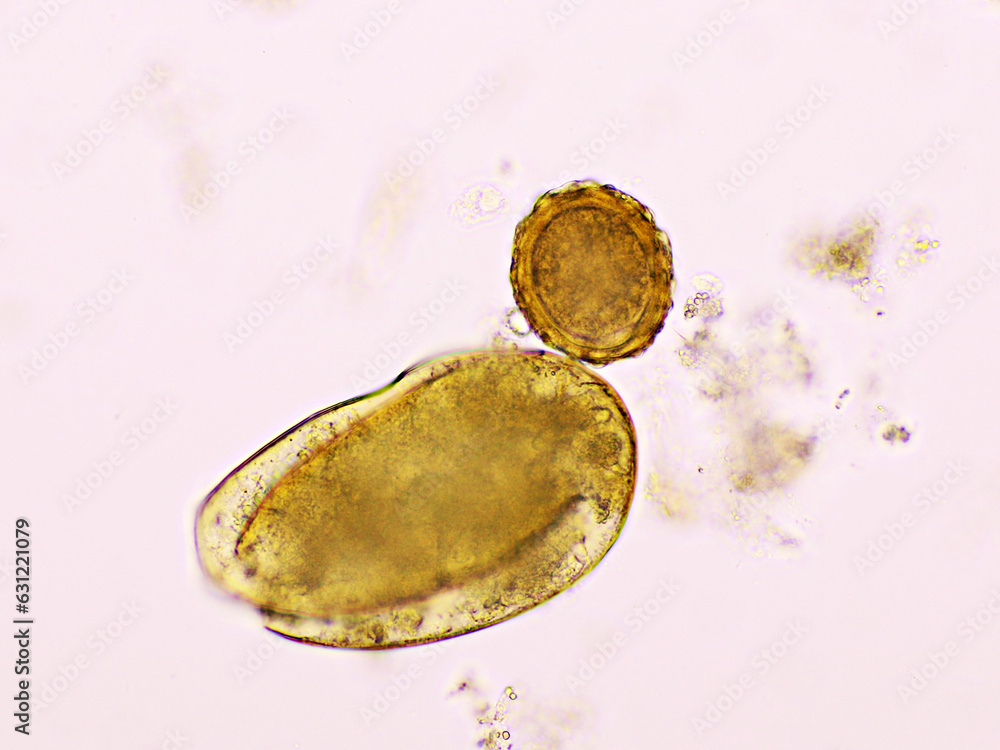 Póster Egg of Ascaris lumbricoides (roundworm) in human stool, analyze ...