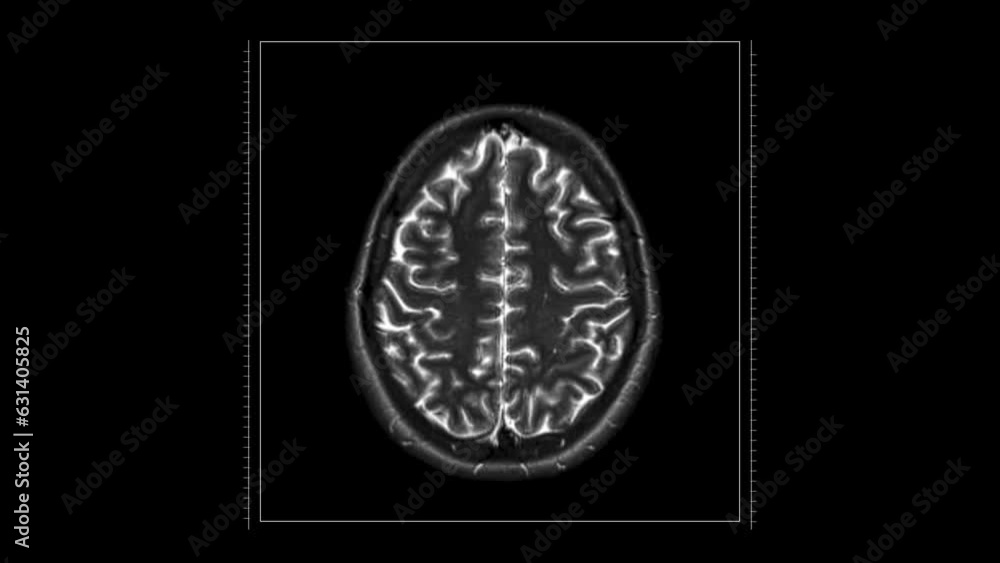 Brain scan visualization animation. Diagnosis data on laboratory ...