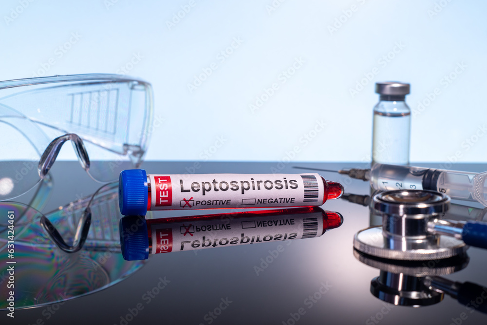 Blood collection tubes Leptospirosis test positive results ...
