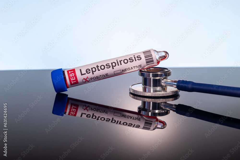 Blood collection tubes Leptospirosis test positive results ...