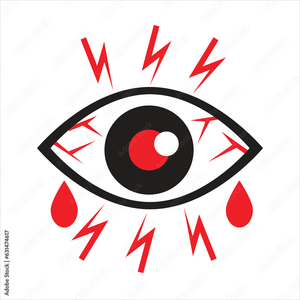 Red Eye flu infection icon, eye disease icon vector symbol, Redness of ...