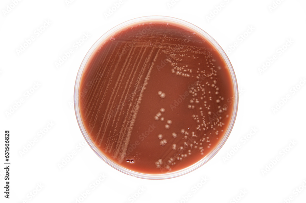 Neisseria gonorrhoeae growing on Thayer-Martin agar Stock Photo | Adobe ...