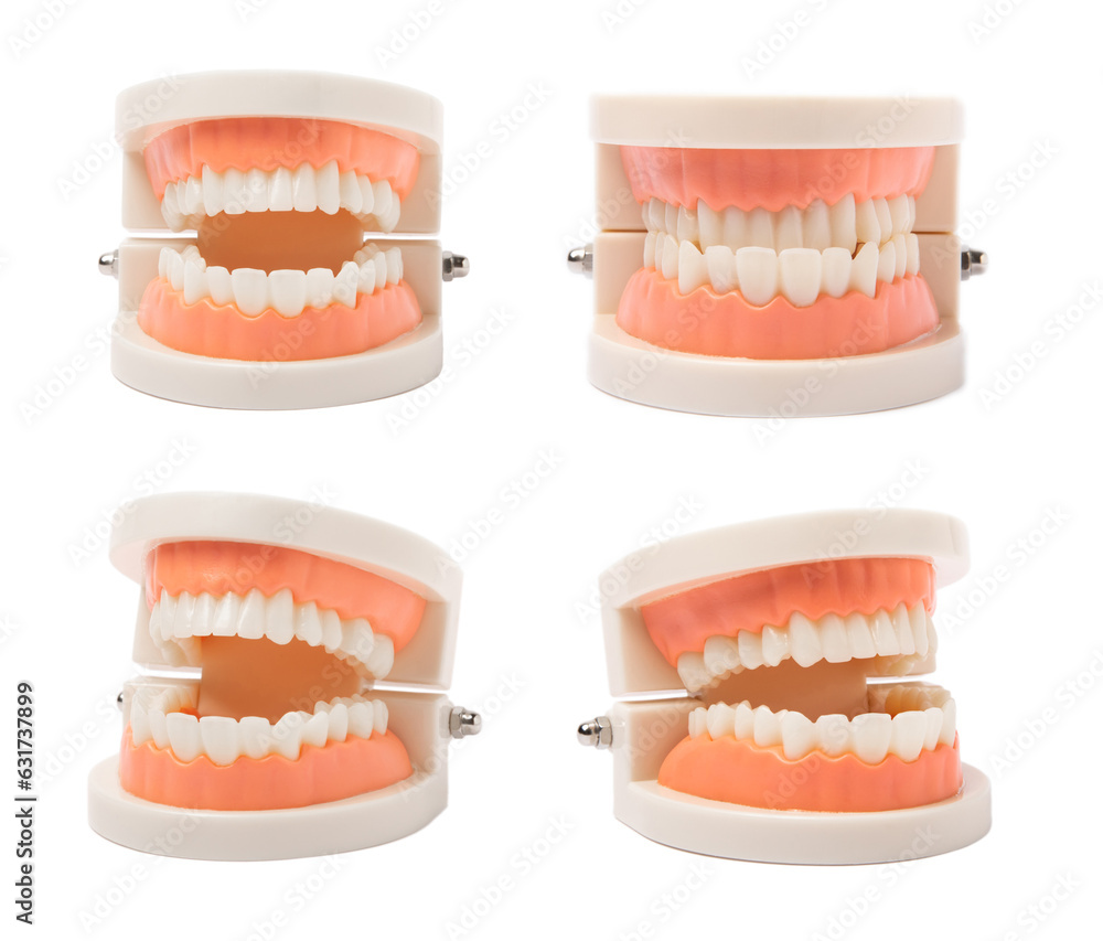 Jaw teeth model isolated on white background. The concept of dental ...