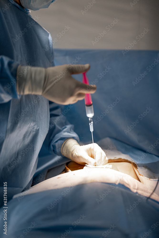 Foto de Surgeon makes an injection during an operation, close-up ...