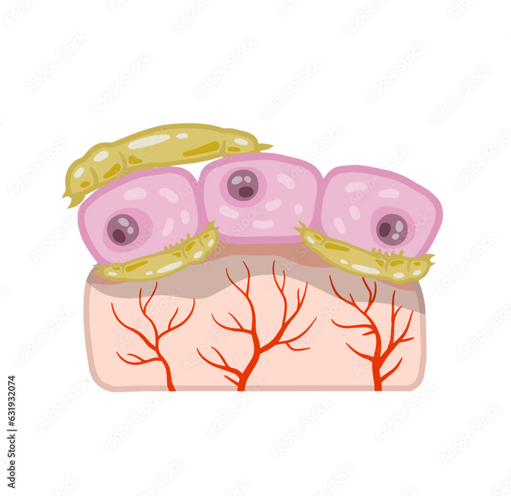 Subcutaneous tick. Skin parasite. Beetles on human epidermis. Harmful ...