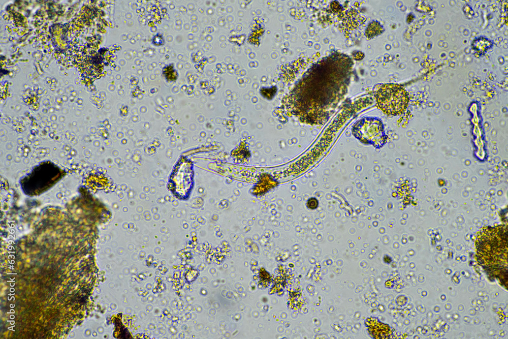 bacterial feeding soil nematode in a soil sample under the microscope ...