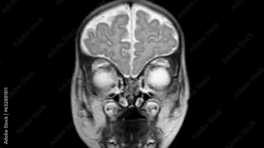 Human Skull 3d Scanning, CT and MRI Scanning Stock Video | Adobe Stock