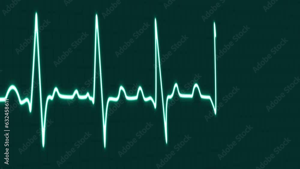 Electrocardiogram frequency heartbeat pulse rate line glowing blue neon ...