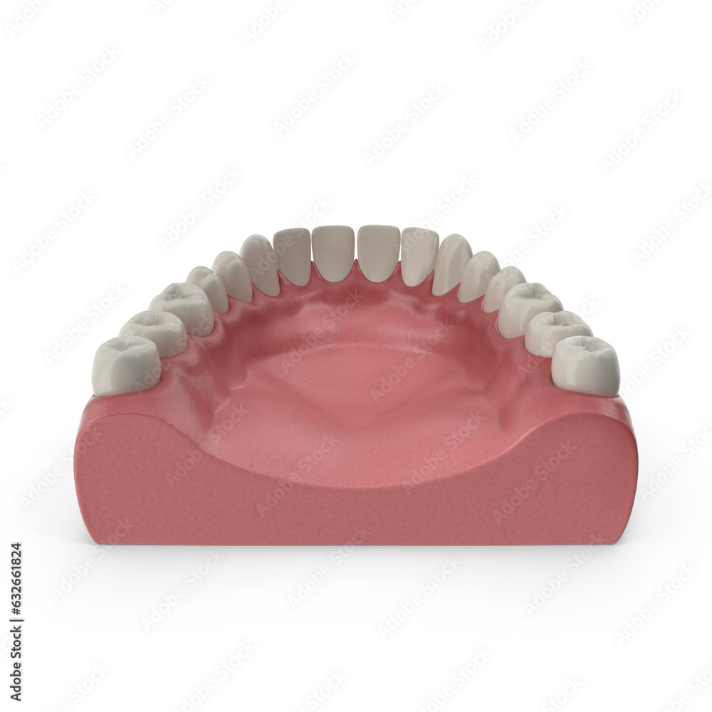 Lower Teeth Medical Model With Dental Implant, jaw with abnormal teeth ...