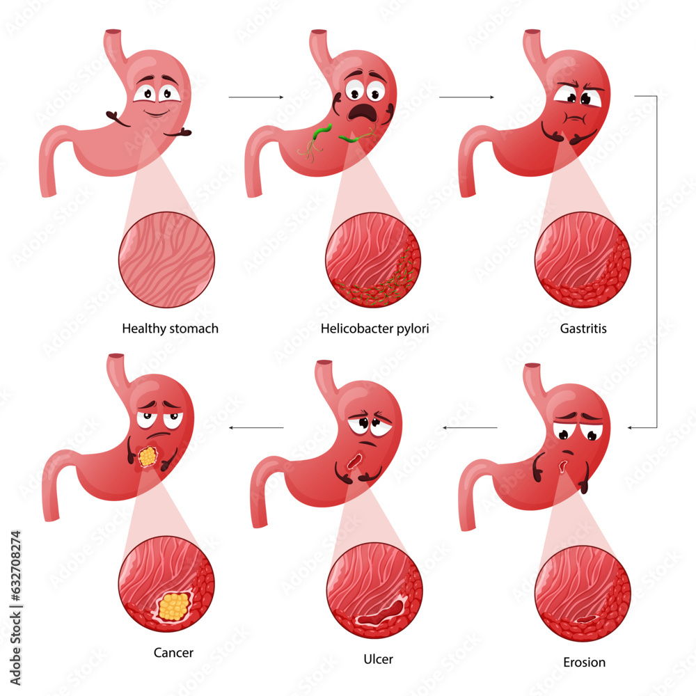 Stomach diseases. Cartoon character with emotions. Diagram diseases ...