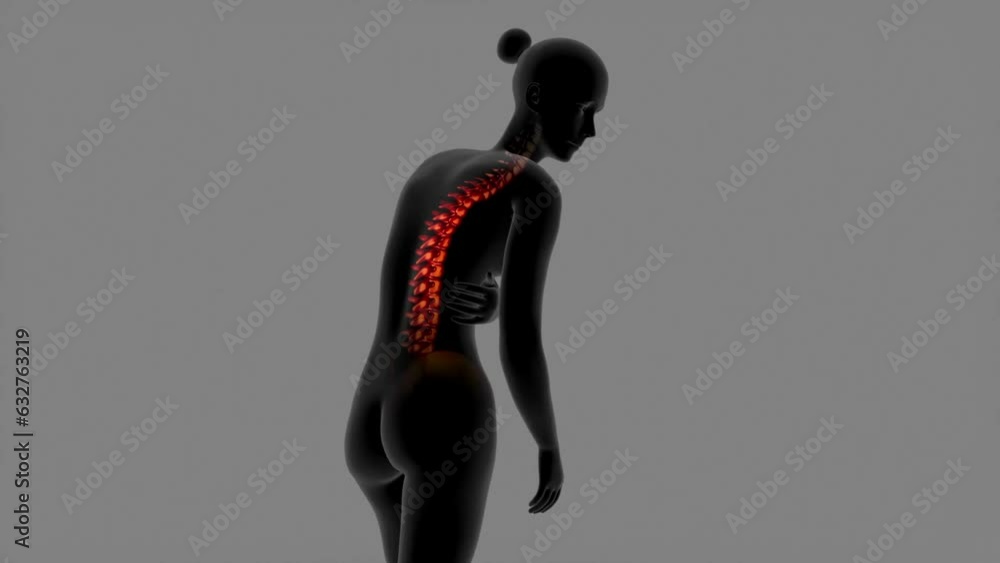 Vidéo Stock Back Pain spinal spine close-up animation Anatomy female ...