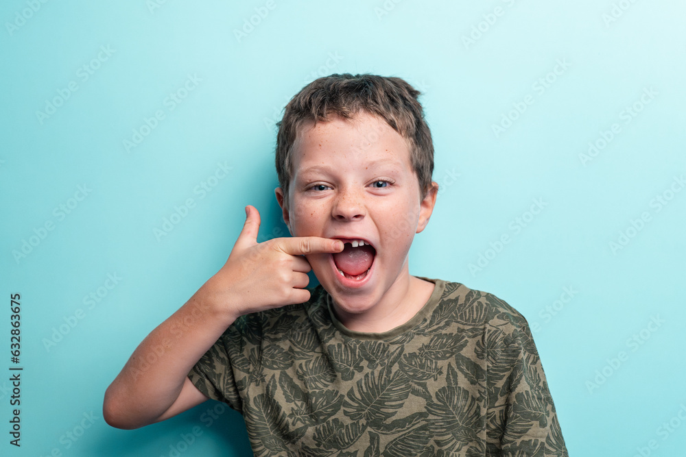 Kid losing his baby teeth. Boy with temporary baby tooth. Happy child ...