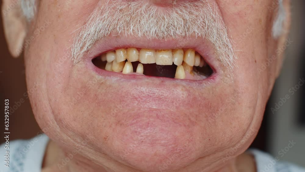 Close-up macro shot of toothless male smile mouth of senior elderly man ...