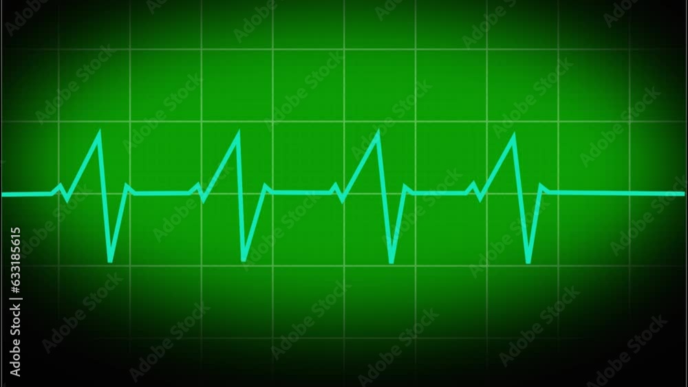 A vector-based image Heartbeat ECG display. The heartbeat ...