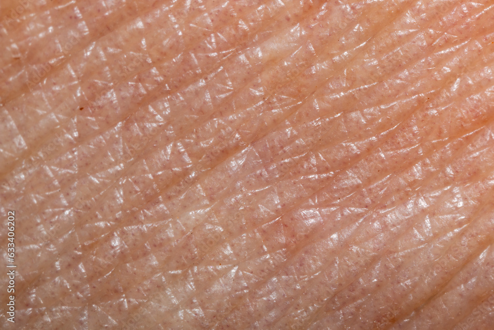 Skin diseases concept. macrophotograph of human skin under microscope ...