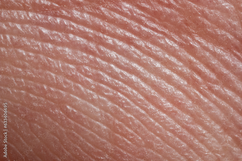 Skin diseases concept. macrophotograph of human skin under microscope ...