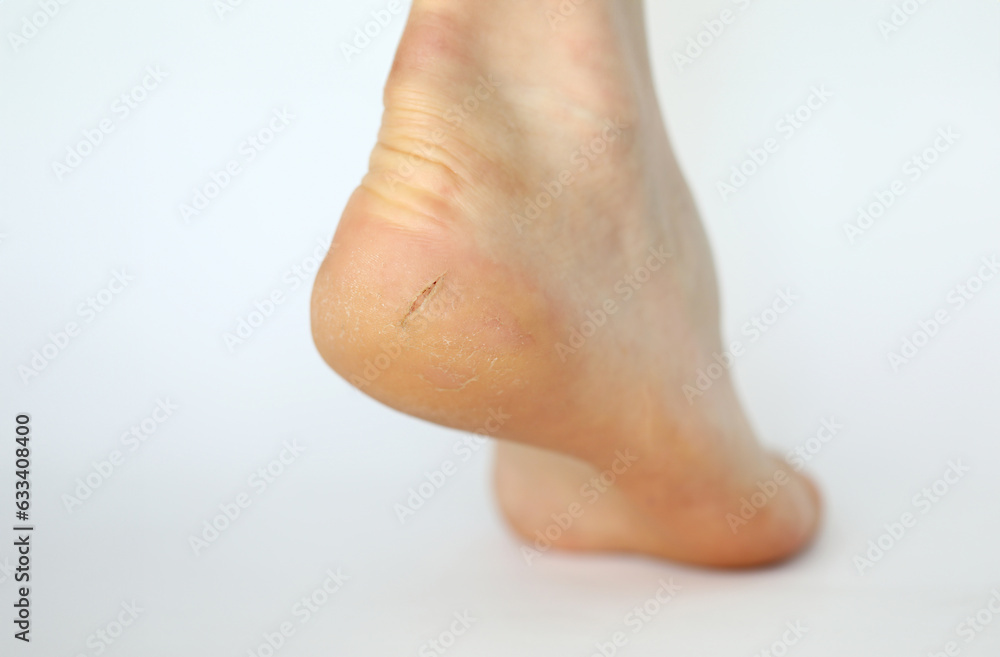 Close-up of female heel shown in modern photography studio to expose ...