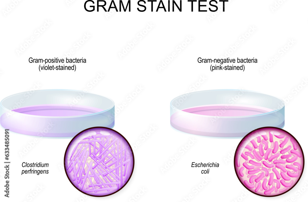 Gram stain test. glass Petri dish with culture Gram-negative and Gram ...