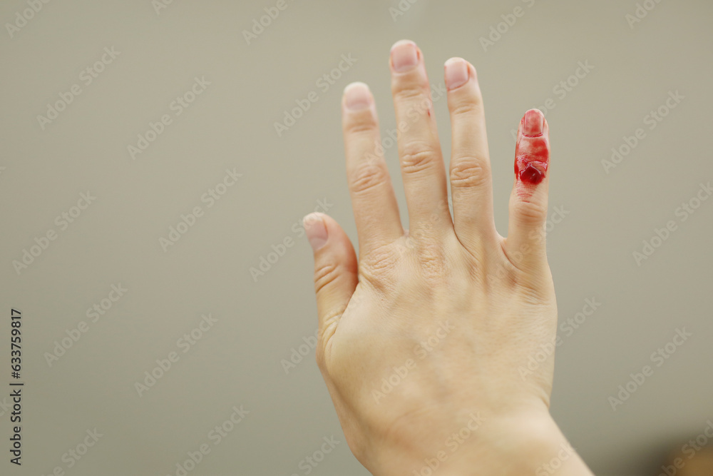 Female hand with red blood, little finger is bleeding profusely. Woman ...
