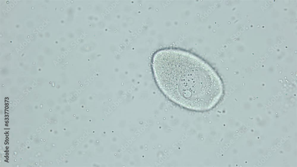 Sperm and ovule of worm Polychaeta Ophelia limacina under microscope ...