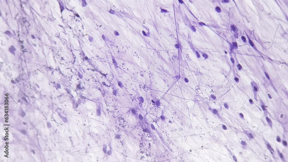 Whole mount of loose connective tissue under microscope with 200 times ...