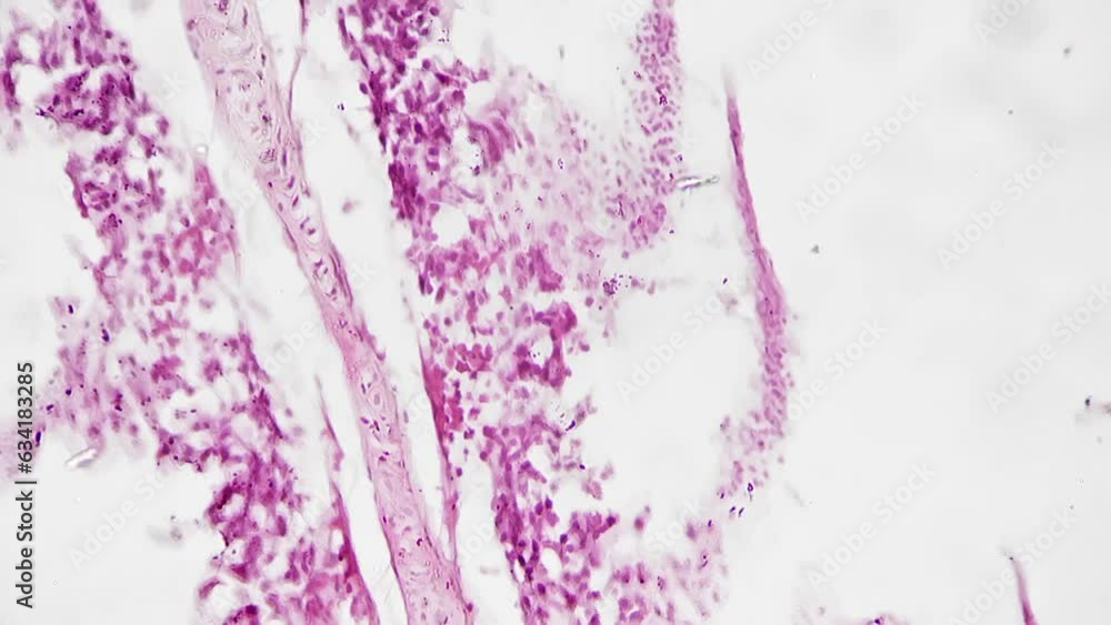 Human ciliated epithelium in section under microscope 400x filmed ...