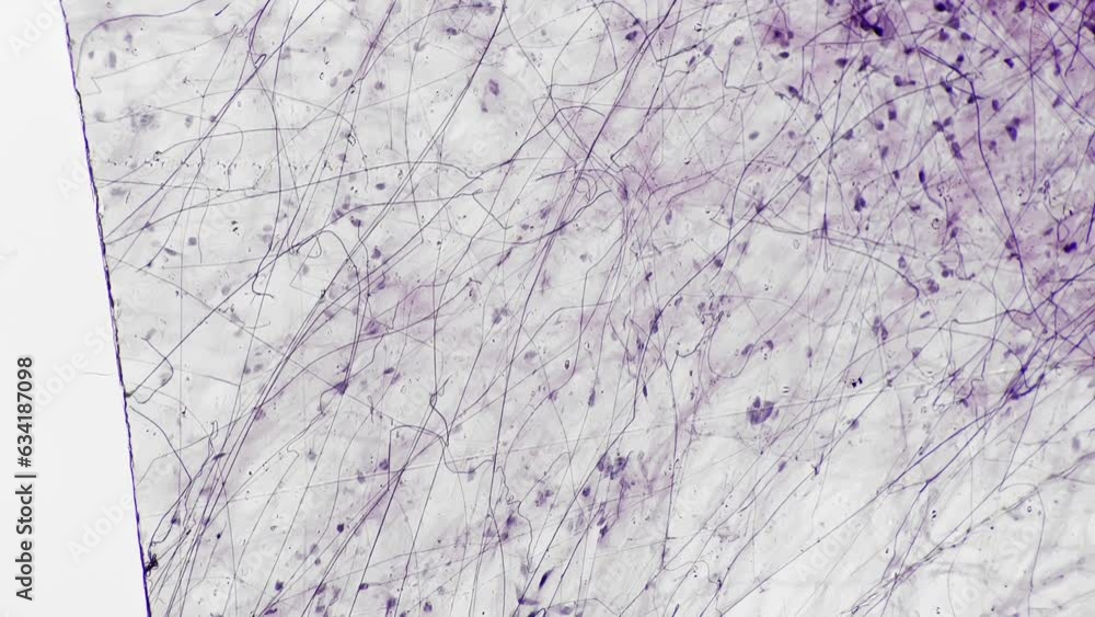 Fibroblast of human being organism magnified under microscope in 100 ...