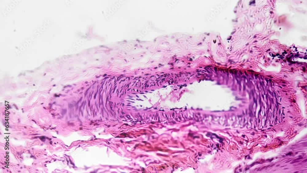 Bladder of human being in section filmed under microscope 200x for ...