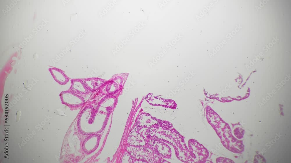 Testis in section of human being at scientific slide magnified under ...