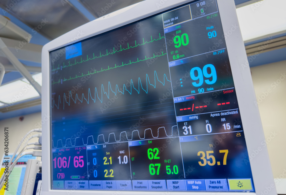 Hospital monitors display vital signs: heart rate, oxygen saturation ...