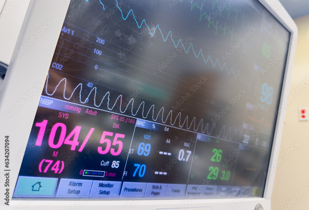 Hospital monitors display vital signs: heart rate, oxygen saturation ...