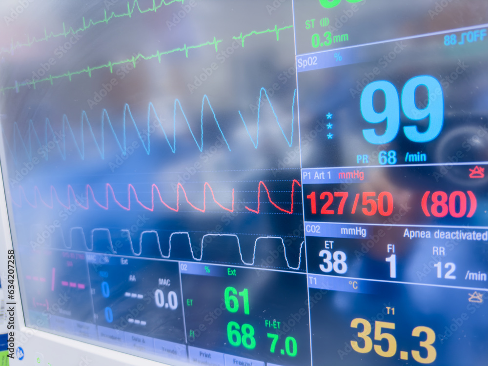 Hospital monitors display vital signs: heart rate, oxygen saturation ...