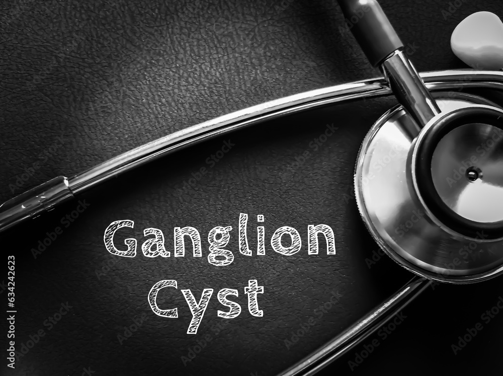 Ganglion Cyst concept, Ganglion cysts are lumps that most often appear ...