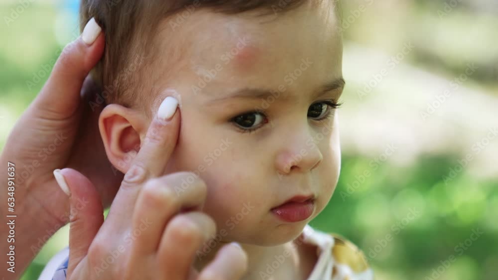 Lovely dark-eyed Caucasian boy stands still while mother applies ...