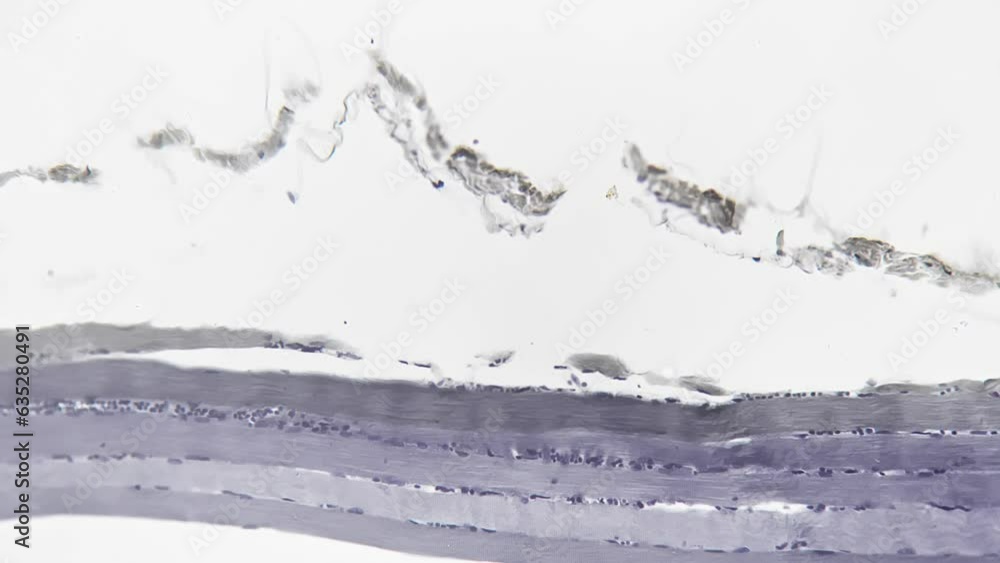 200 times magnification of human skeletal muscle in longitudinal ...