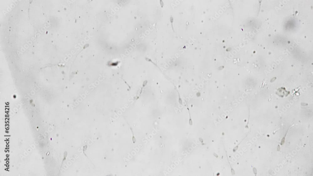 Macro footage of sperm smear sample magnified under microscope 400x and ...