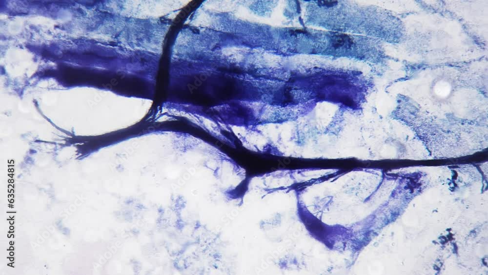 Whole mount of human motor nerve endings in the pattern filmed under ...